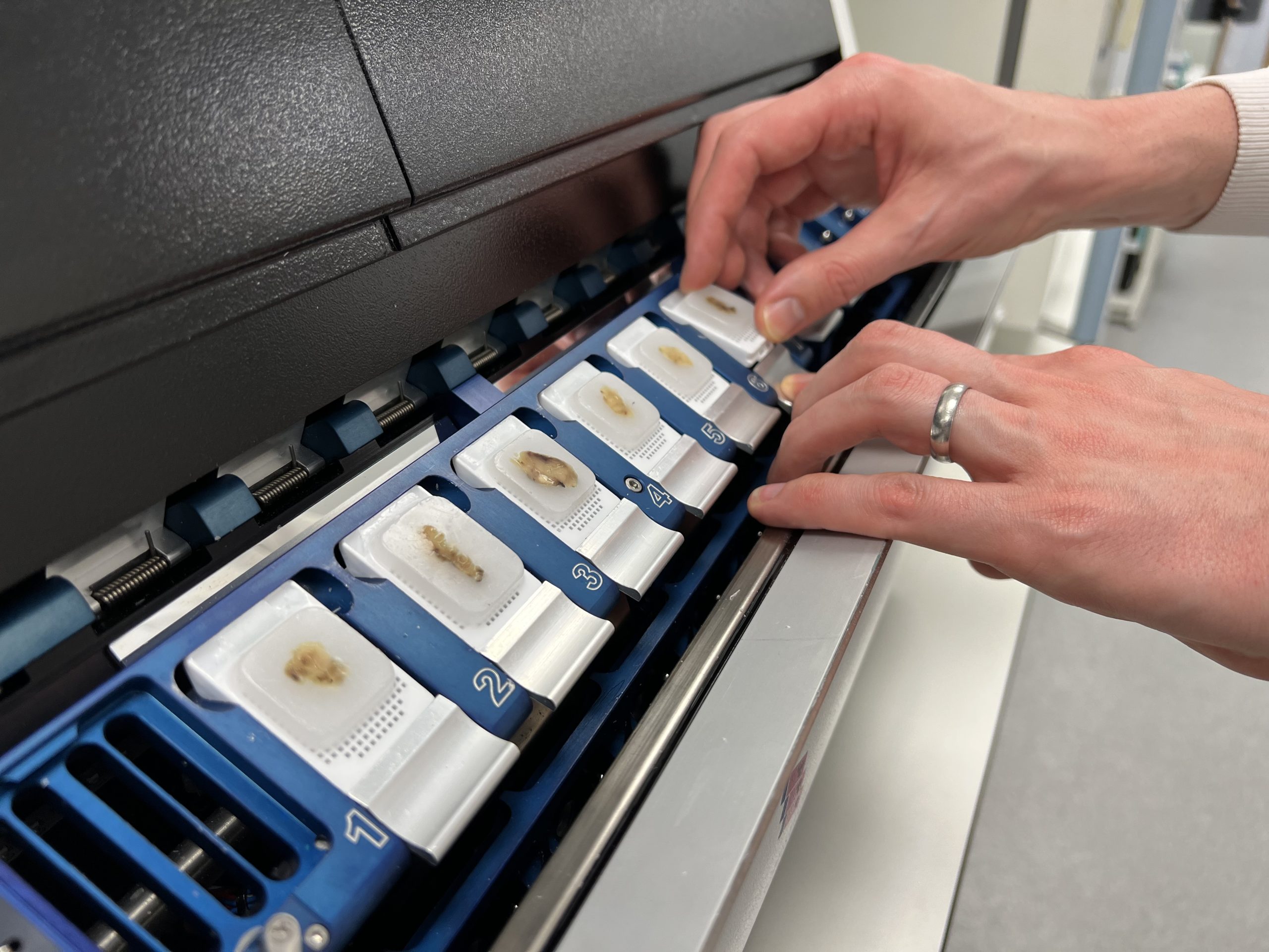 Generation of tissue microarray (TMA) - Commercial Services at Newcastle Hospitals