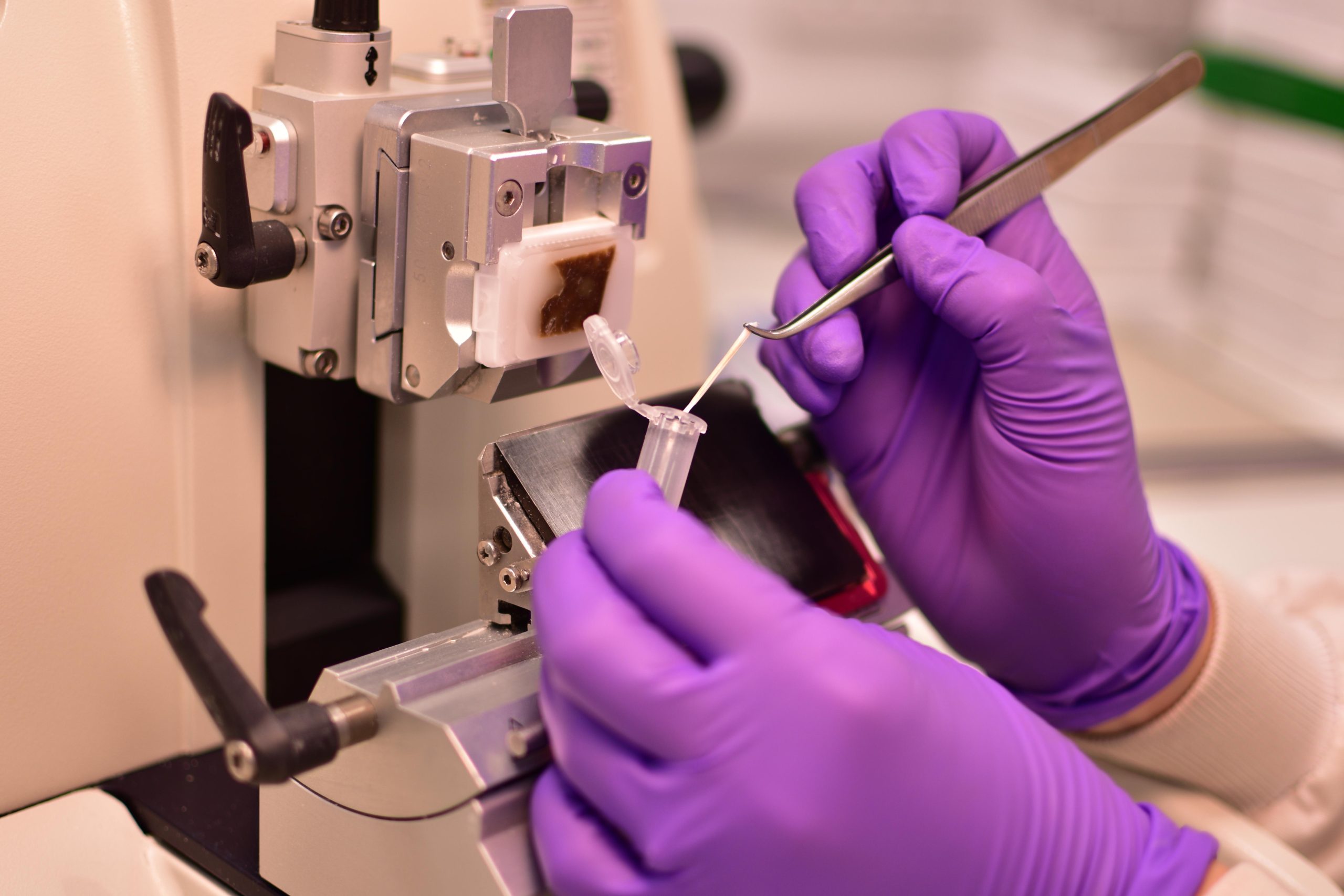 Clinical sample types - Commercial Services at Newcastle Hospitals