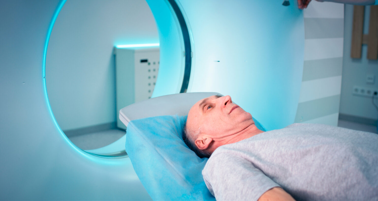 Lung cancer screening (previously known as the Targeted Lung Health ...